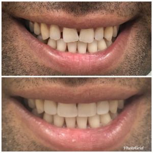 Livingston Dentistry